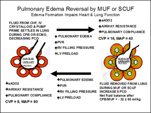How Ultrafiltration And MUF During Cardiopulmonary Bypass Really Work!